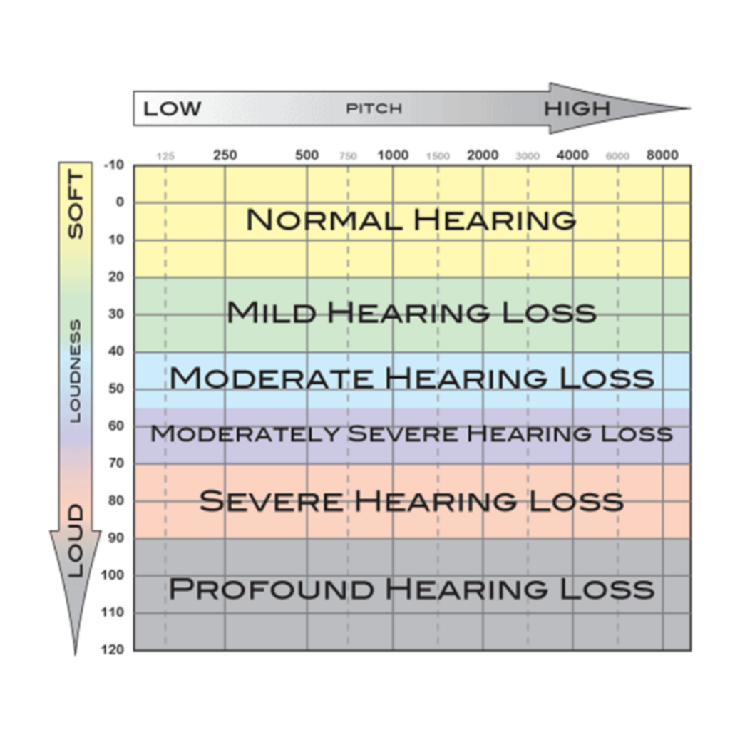 Understanding the Extent of Hearing Loss: - Pardon Me the Hearing Aid Store